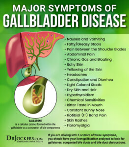 22 Symptoms of GallBladder Disease - DrJockers.com