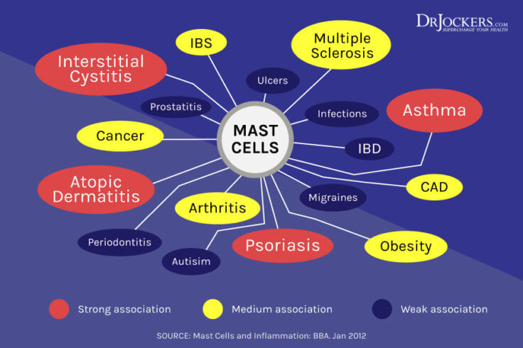 Mast Cell Activation Syndrome: Symptoms and Support Strategies
