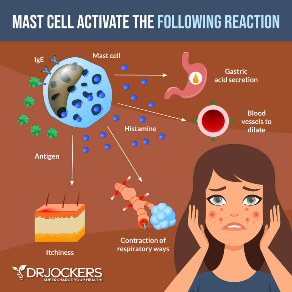 Mast Cell Activation Syndrome: Symptoms and Support Strategies