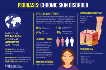 Psoriasis: Causes, Symptoms & Natural Support Strategies