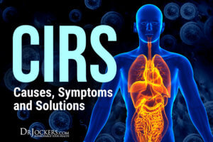 CIRS: Causes, Symptoms and Solutions - DrJockers.com