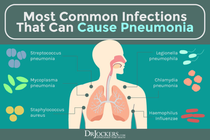 Pneumonia: Causes, Symptoms & Support Strategies - DrJockers.com