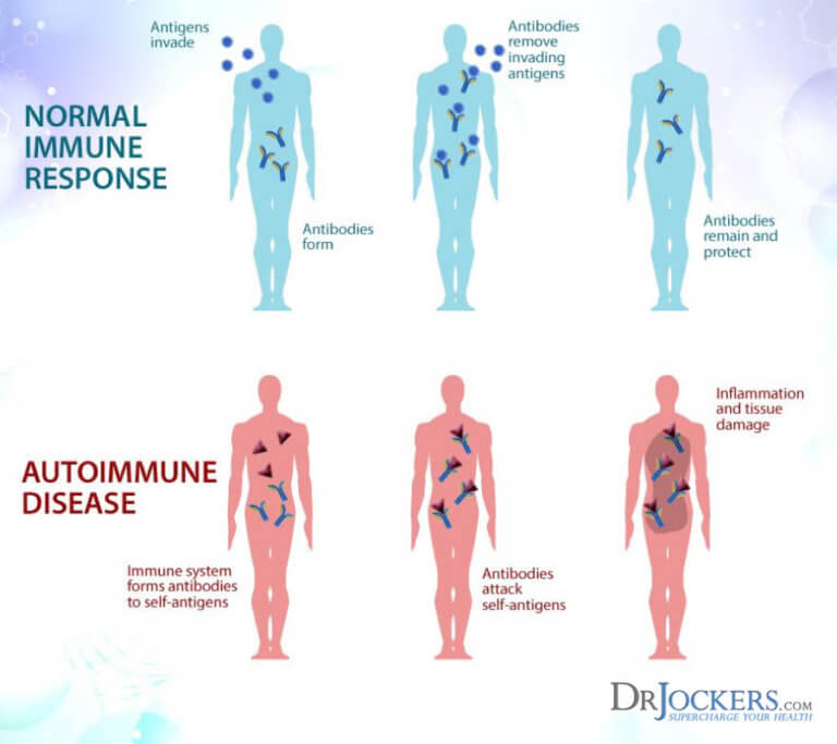 5 Steps to Heal Autoimmune Disease - DrJockers.com