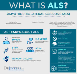 ALS: Symptoms, Causes, and Natural Support Strategies - DrJockers.com