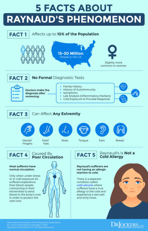 Raynaud's Phenomenon: Causes, Symptoms & Support Strategies