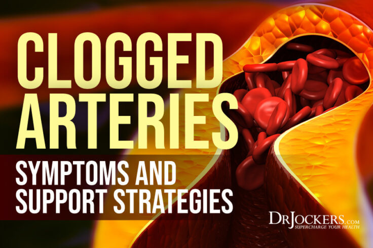 Clogged Arteries: Causes, Symptoms & Support Strategies