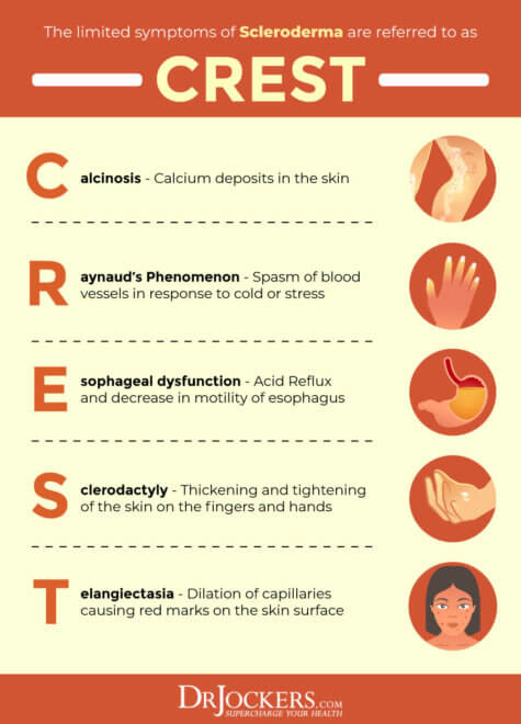 Scleroderma: Causes, Symptoms and Natural Support Strategies