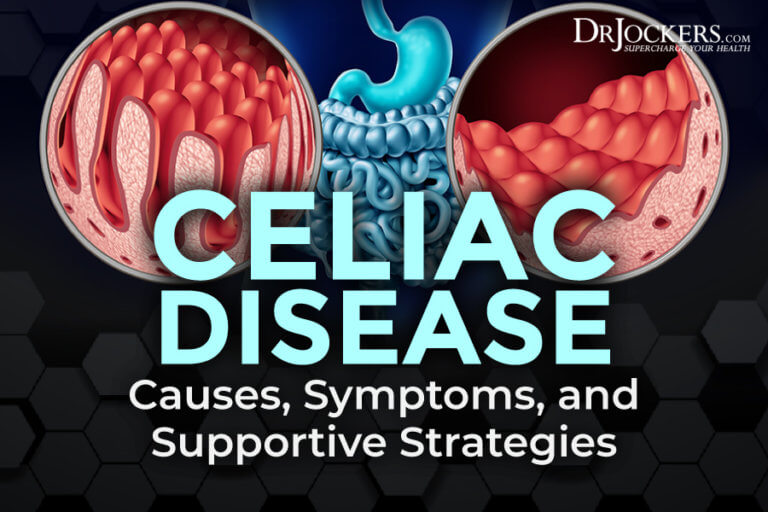 Celiac Disease: Symptoms, Causes and Natural Support Strategies