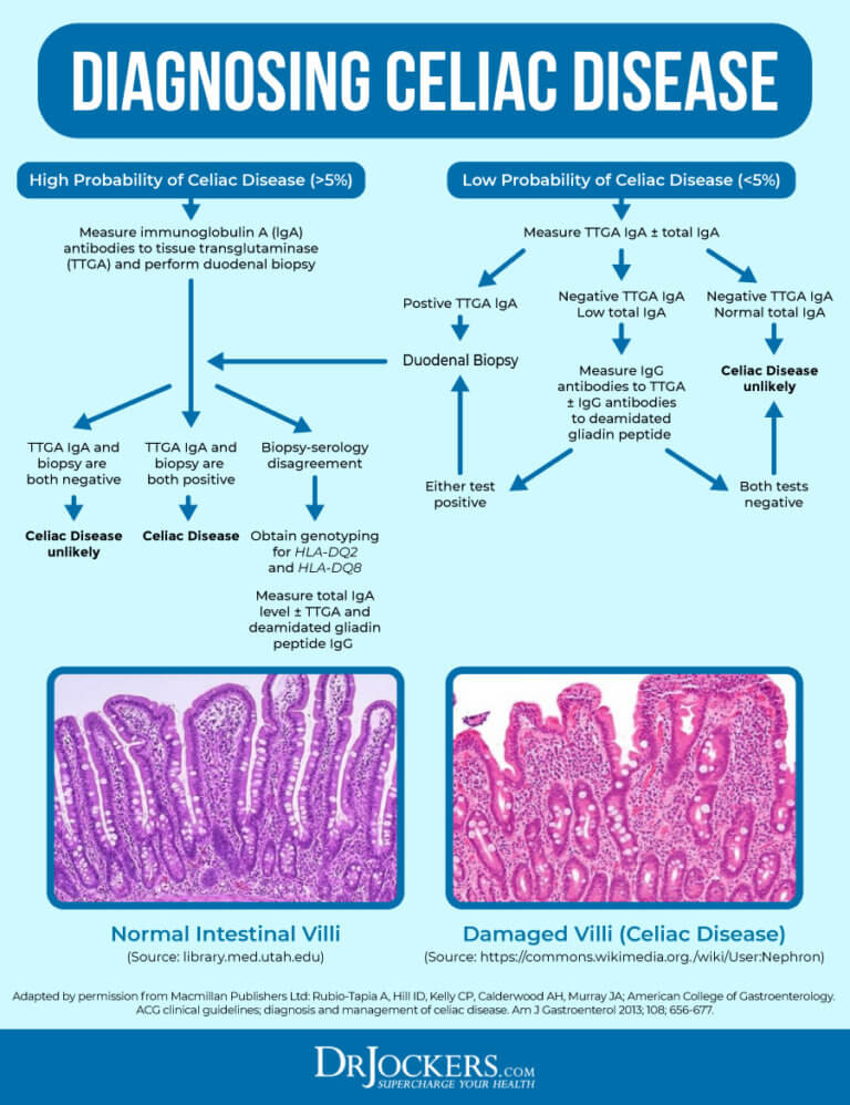 Celiac Disease: Symptoms, Causes and Natural Support Strategies
