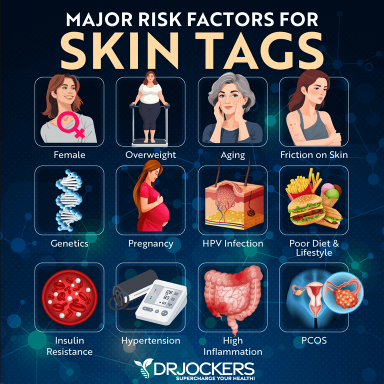 Skin Tags: Major Causes and Natural Support Strategies - DrJockers.com