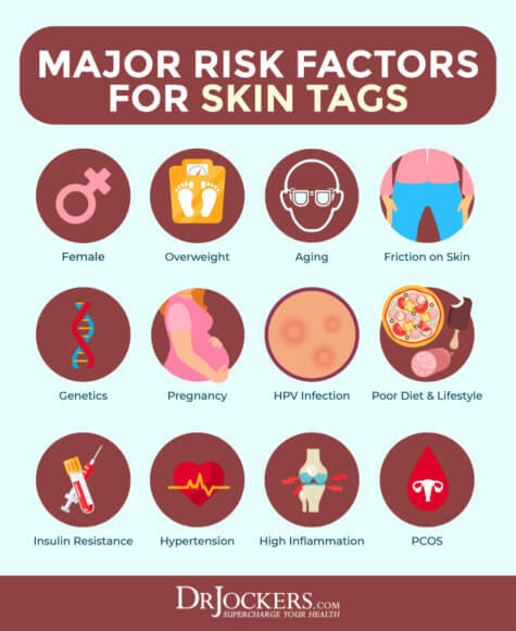 Skin Tags: Major Causes and Natural Support Strategies - DrJockers.com