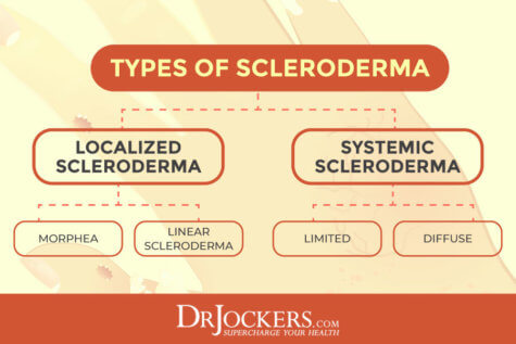 Scleroderma: Causes, Symptoms and Natural Support Strategies