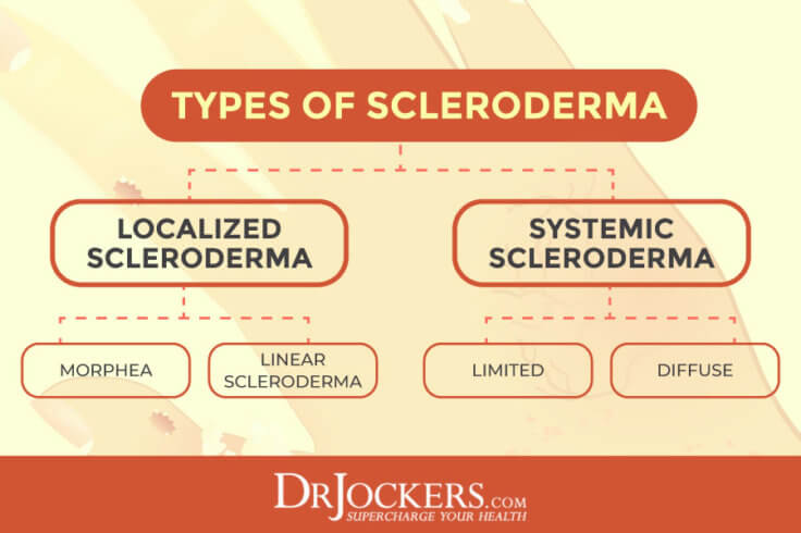 Scleroderma: Causes, Symptoms and Natural Support Strategies