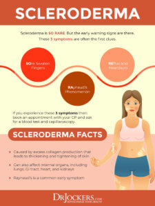 Scleroderma: Causes, Symptoms and Natural Support Strategies
