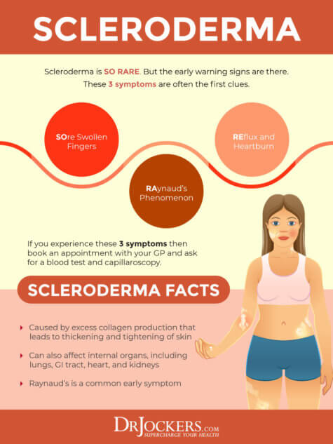 Scleroderma: Causes, Symptoms and Natural Support Strategies