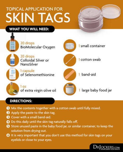Skin Tags: Major Causes and Natural Support Strategies - DrJockers.com