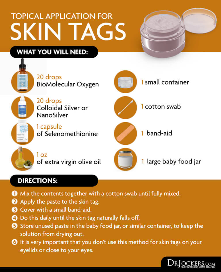 Skin Tags: Major Causes and Natural Support Strategies - DrJockers.com