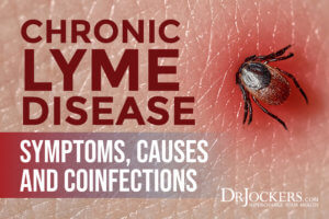 Chronic Lyme Disease: Symptoms, Causes and CoInfections