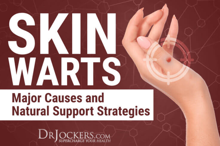 Skin Warts: Major Causes and Natural Support Strategies