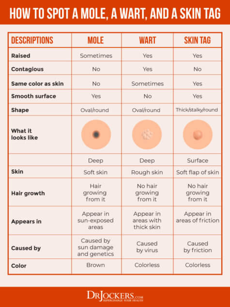 Skin Tags: Major Causes and Natural Support Strategies - DrJockers.com
