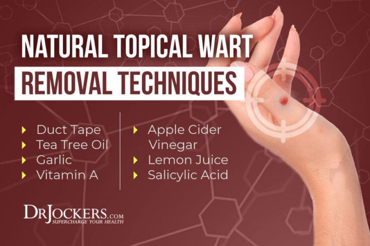 Skin Warts: Major Causes and Natural Support Strategies