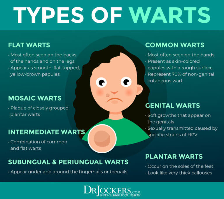Skin Warts: Major Causes and Natural Support Strategies
