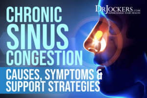 Sinus Congestion: Causes, Symptoms & Support Strategies
