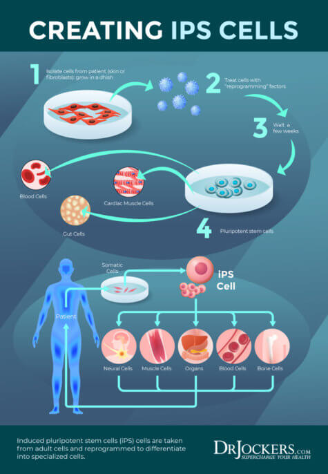Stem Cells: What Are They and 8 Ways to Activate Them - DrJockers.com