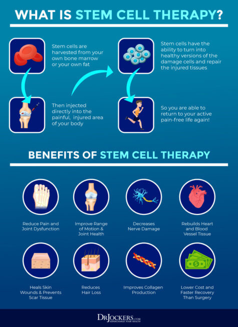 Stem Cells: What Are They and 8 Ways to Activate Them - DrJockers.com