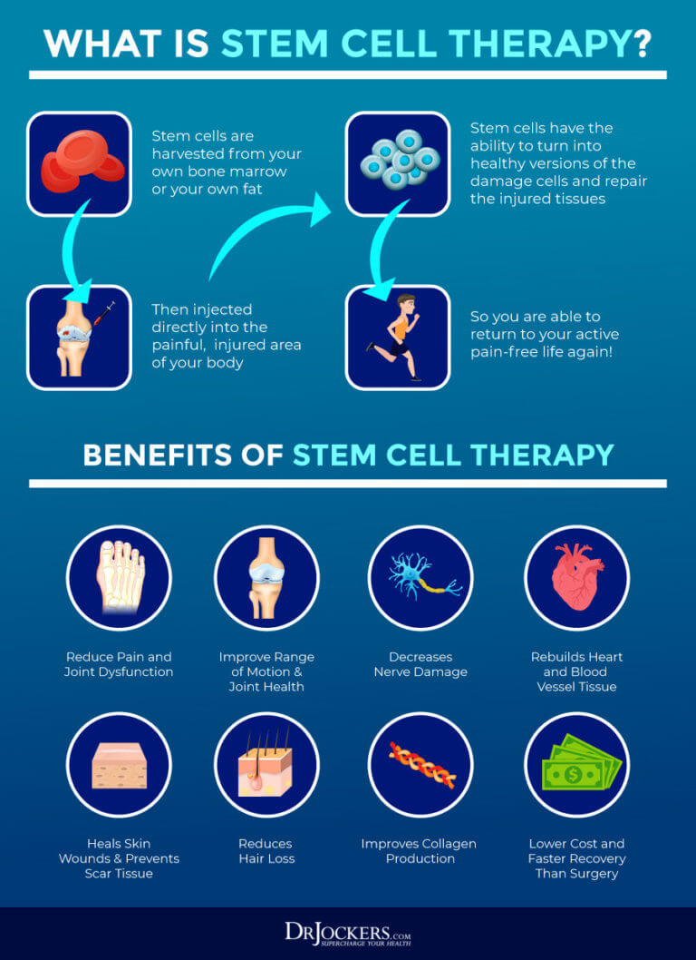 Stem Cells: What Are They and 8 Ways to Activate Them - DrJockers.com