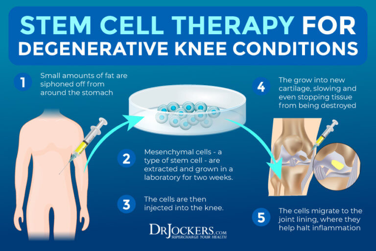 Stem Cells: What Are They and 8 Ways to Activate Them - DrJockers.com