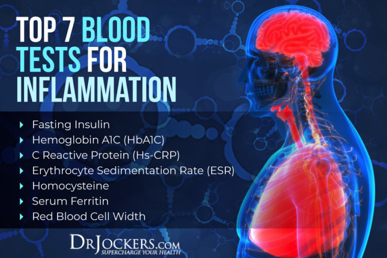 Inflammaging: The Role of Inflammation in the Acceleration of Aging