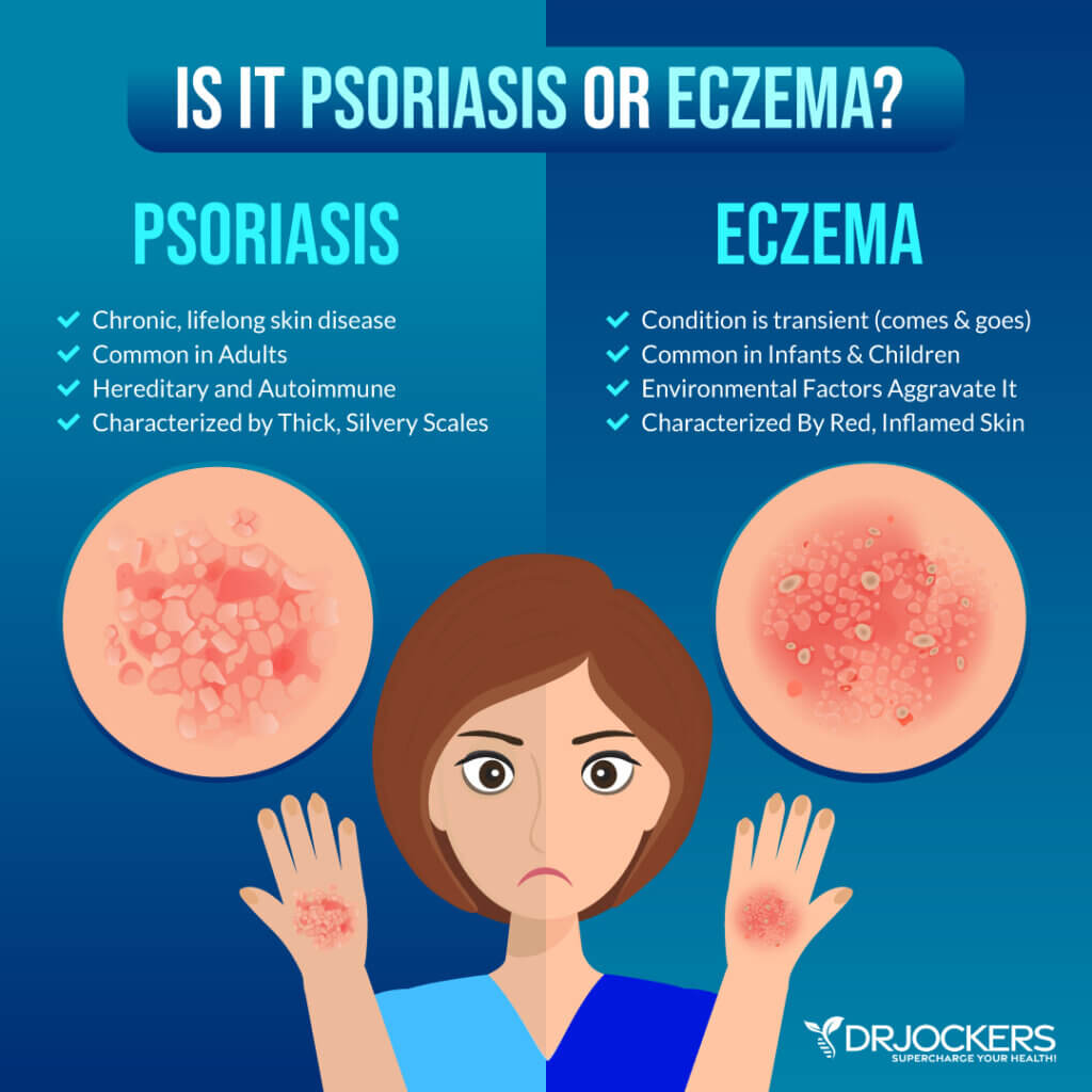 Skin Inflammation: Symptoms, Causes and Support Strategies