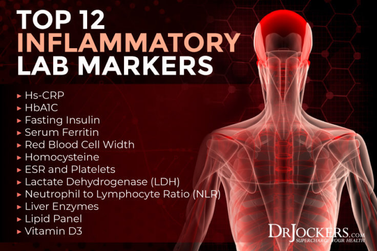 Top 12 Inflammatory Lab Markers and Optimal Ranges