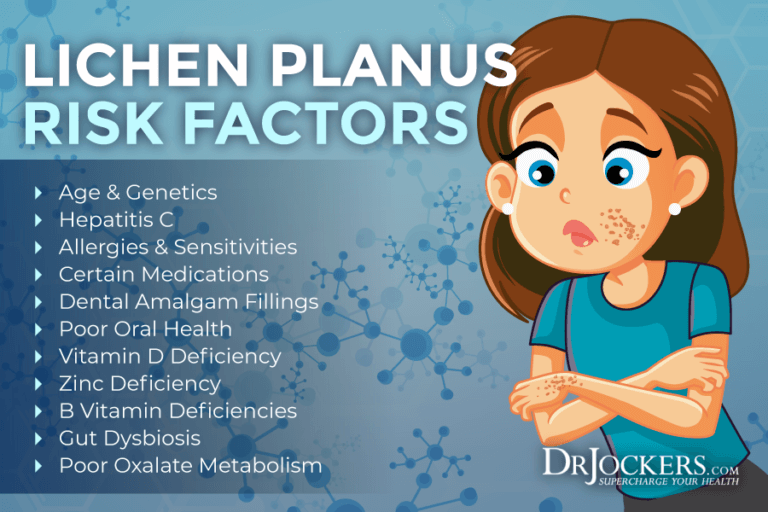 Lichen Planus: Symptoms, Causes and Support Strategies
