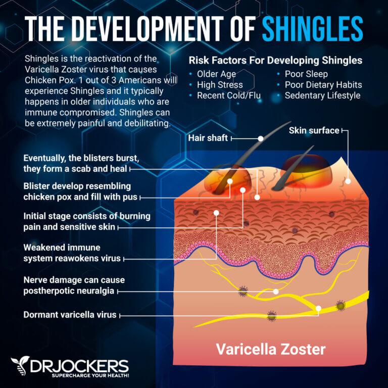 Shingles: Symptoms, Risk Factors, and Natural Support Strategies