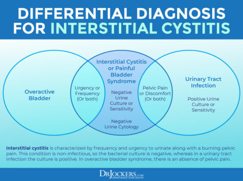 Interstitial Cystitis: Symptoms, Causes and Support Strategies