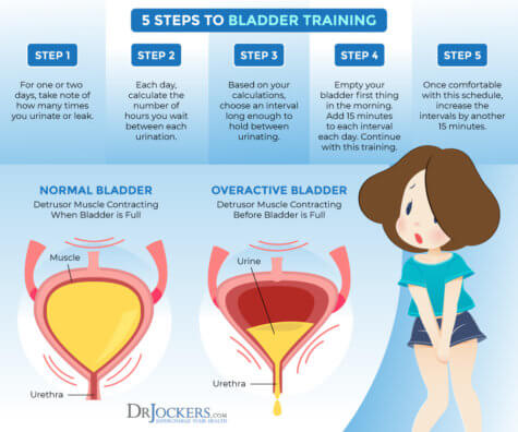 Interstitial Cystitis: Symptoms, Causes and Support Strategies