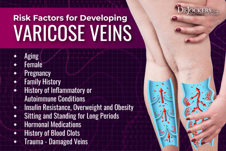 Varicose Veins: Symptoms, Causes and Natural Support Strategies