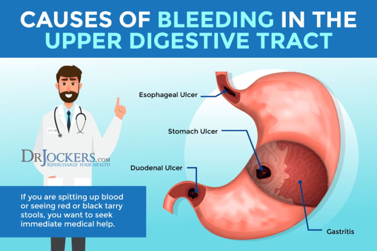 Gastritis: Symptoms, Causes, and Support Strategies - DrJockers.com