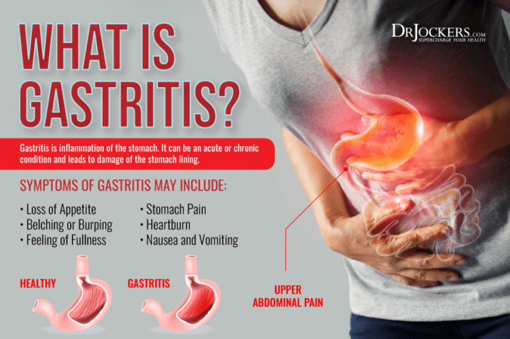 Gastritis: Symptoms, Causes, and Support Strategies - DrJockers.com