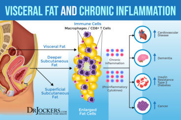Visceral Fat: What is It and How it Drives Up Inflammation
