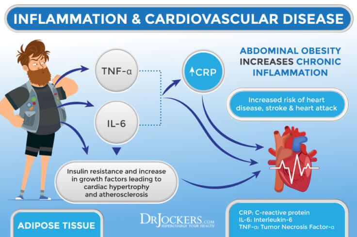 Visceral Fat: What is It and How it Drives Up Inflammation - DrJockers.com