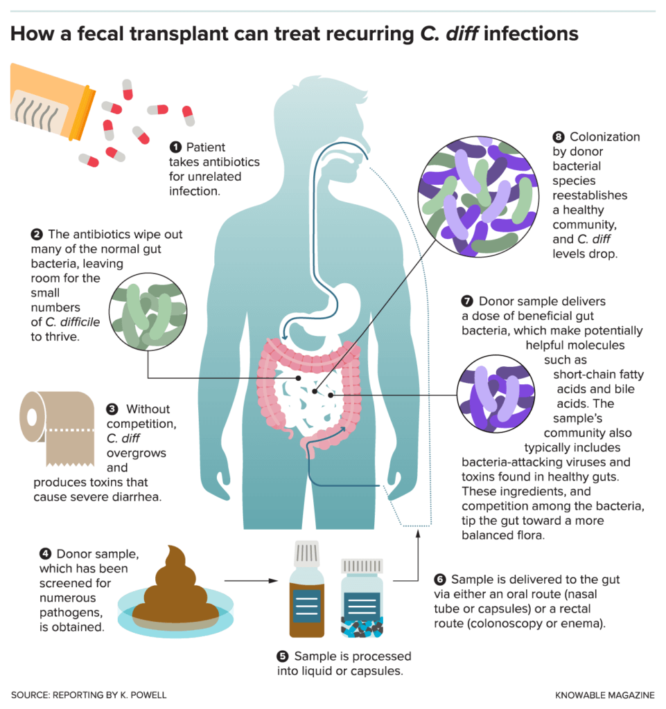 C Diff Infection: Risk Factors, Symptoms and Support Strategies