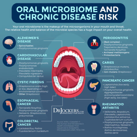 Holistic Dental Care and the Oral Microbiome - DrJockers.com
