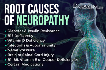 Neuropathy: Risk Factors, Causes and Support Strategies