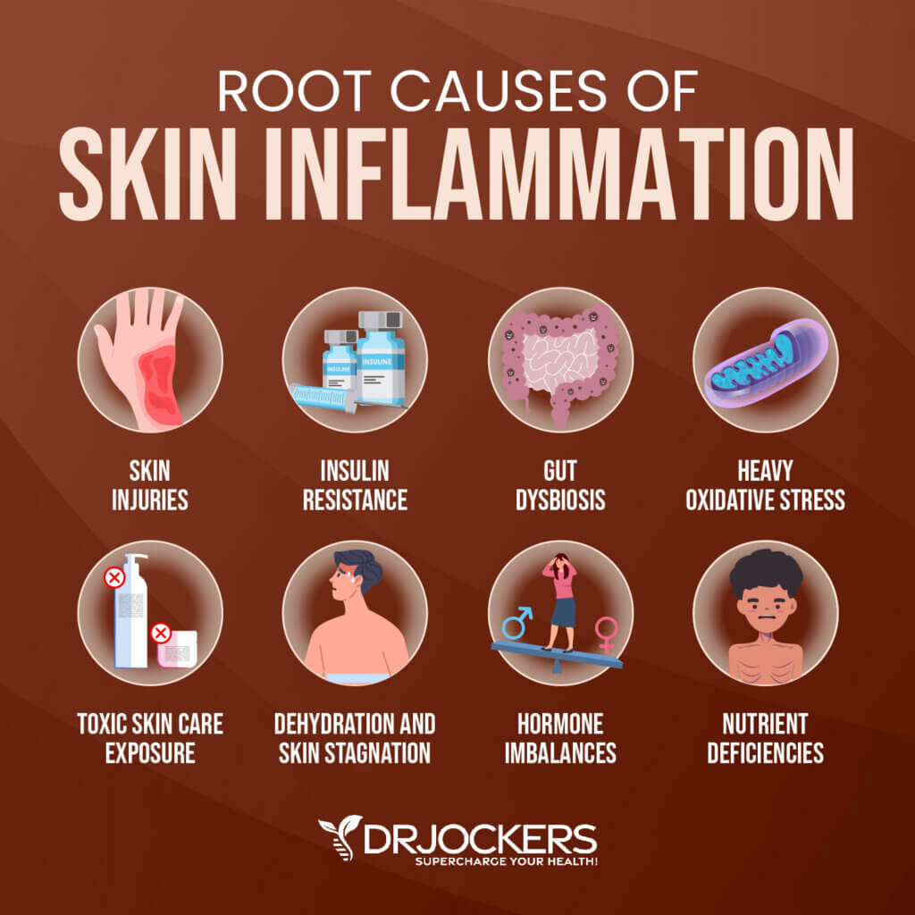 Skin Inflammation: Symptoms, Causes and Support Strategies