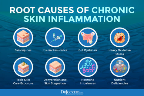 Skin Inflammation: Symptoms, Causes and Support Strategies