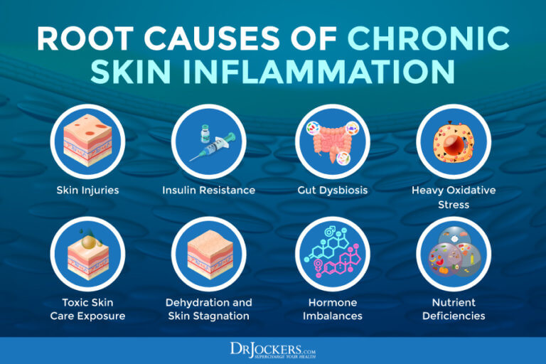 Skin Inflammation: Symptoms, Causes and Support Strategies