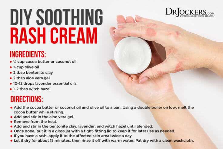 Skin Rashes: Symptoms, Causes and Natural Support Strategies